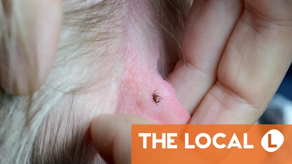 TBE infections hit monthly record high in Sweden